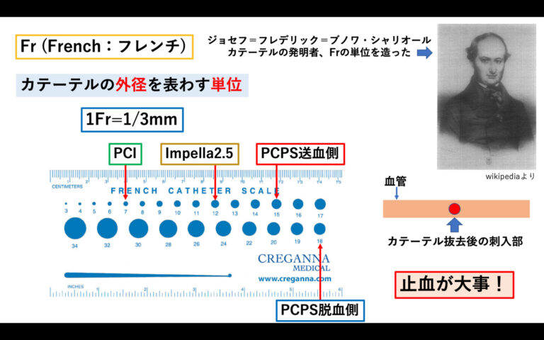 1Frって何mm？【由来から解説】 | もふごろ循環器のガチレビュー