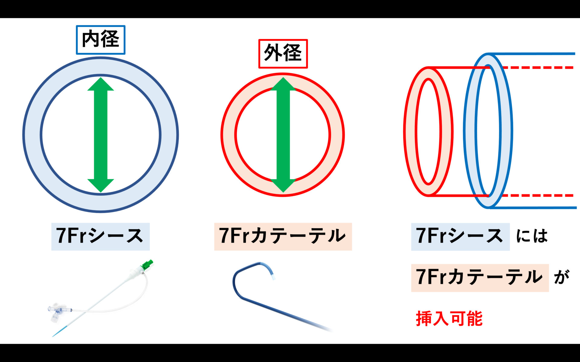 1Frって何mm？【徹底比較】 | もふごろ循環器
